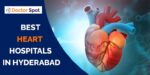 Best Heart Hospitals in Delhi - DoctorSpot